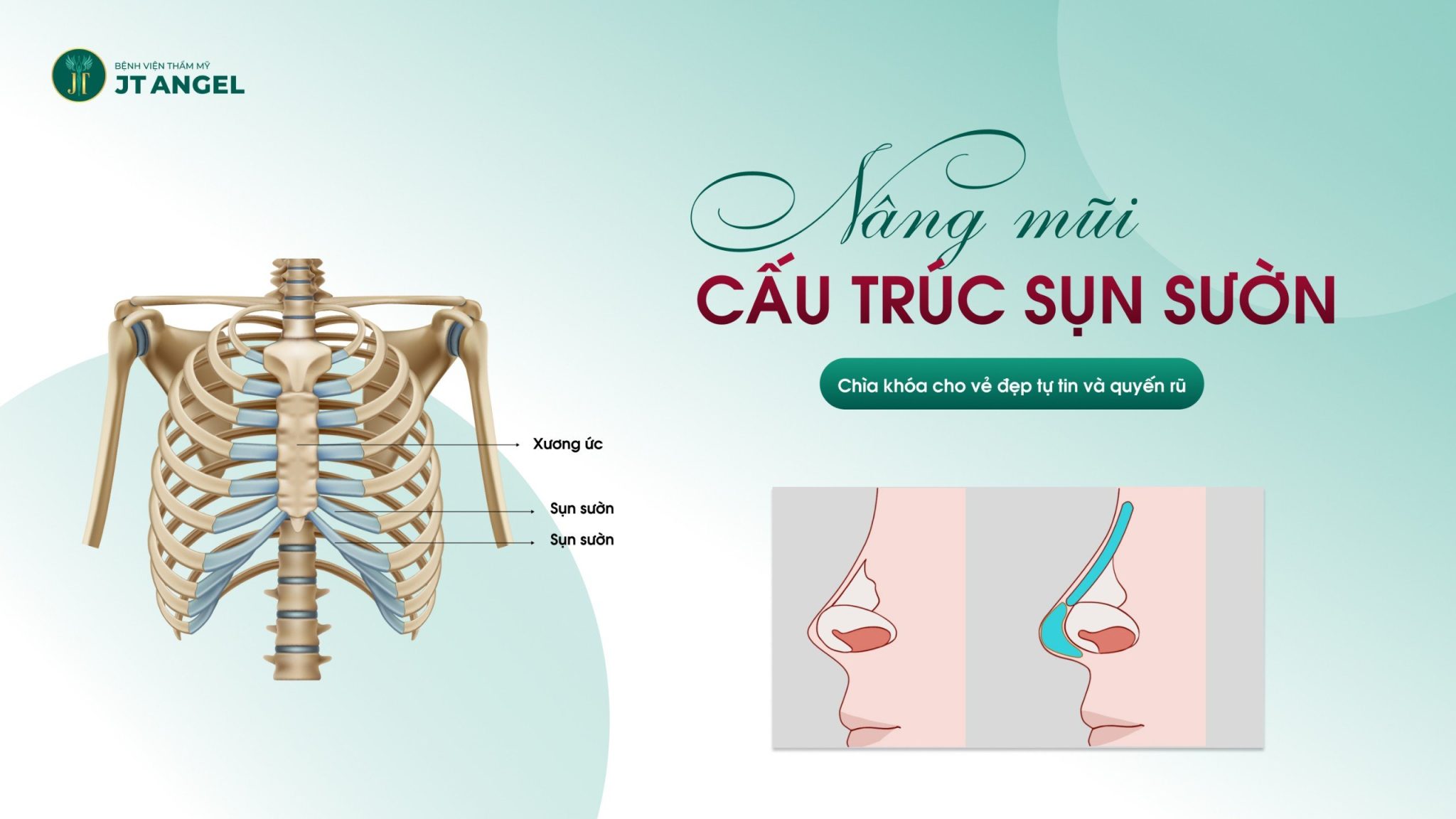 Nâng mũi cấu trúc sụn sườn: Chìa khóa cho vẻ đẹp tự tin và quyến rũ