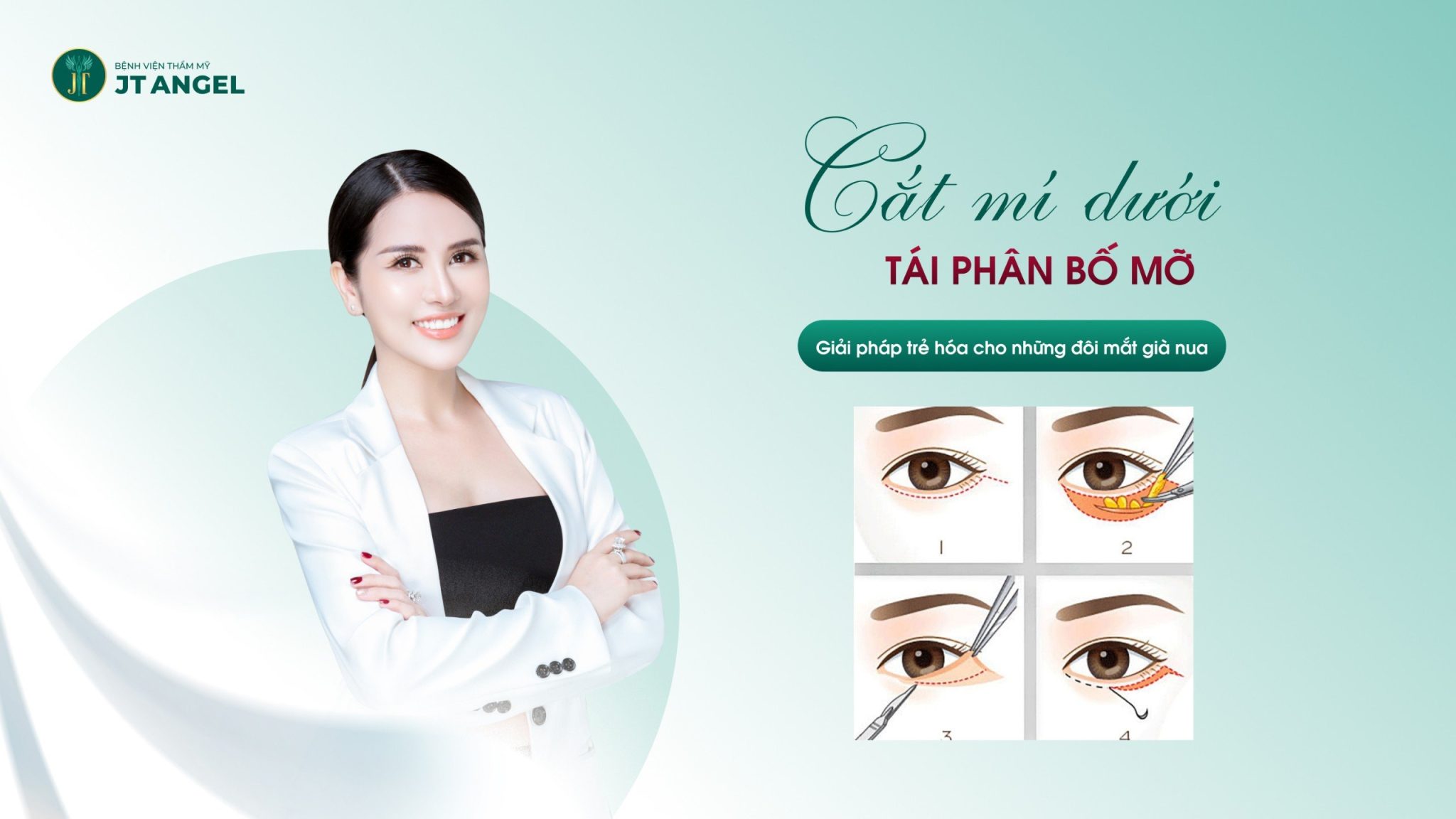 Cắt mắt - Nhấn mí - Bệnh viện thẩm mỹ JT ANGEL