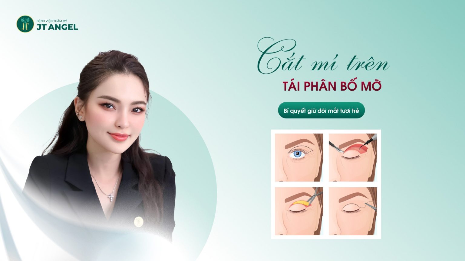 Cắt mắt - Nhấn mí - Bệnh viện thẩm mỹ JT ANGEL