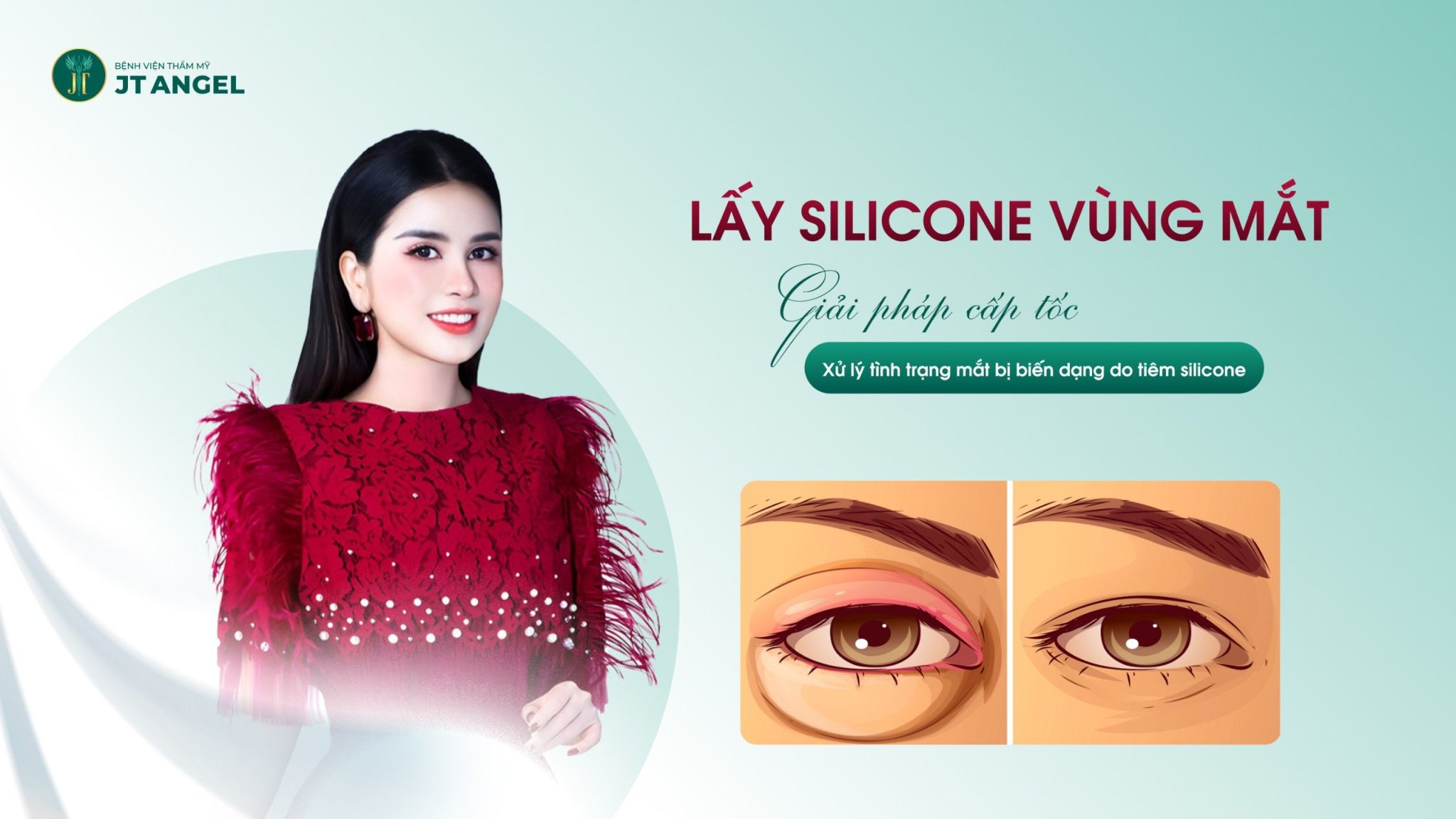 Dịch vụ - Bệnh viện thẩm mỹ JT ANGEL