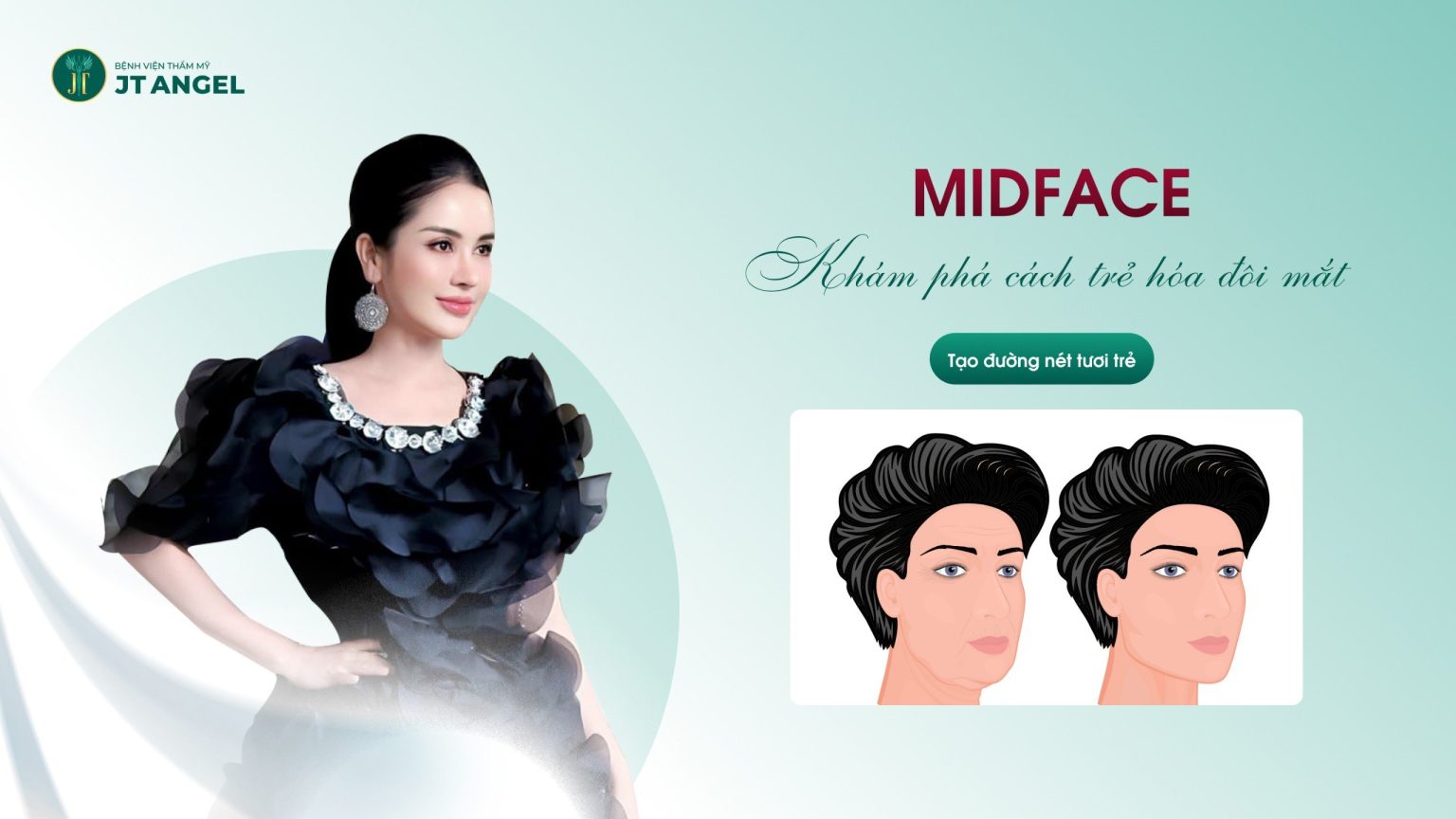 Midface: Khám phá cách trẻ hóa đôi mắt và tạo đường nét tươi trẻ