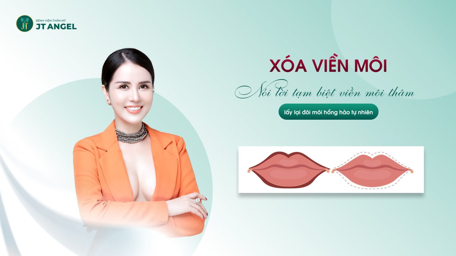 Xóa viền môi: Nói lời tạm biệt viền môi thâm, lấy lại đôi môi hồng hào tự nhiên