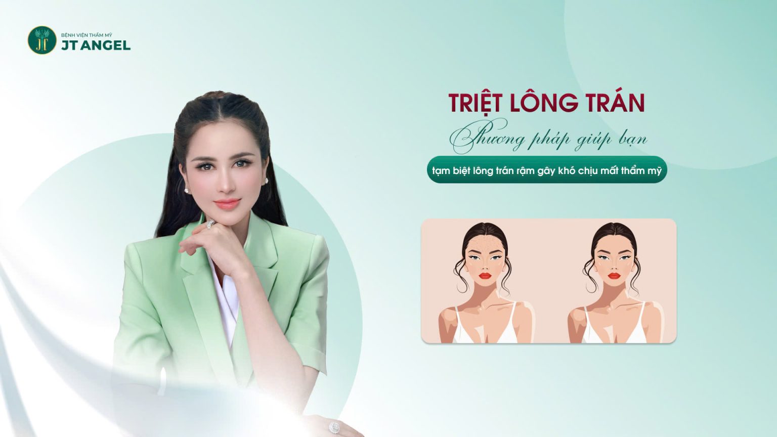 Triệt lông trán: Phương pháp giúp bạn tạm biệt lông trán rậm gây khó ...