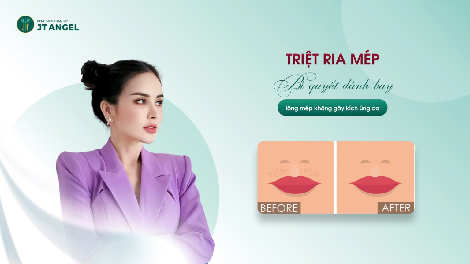 Triệt ria mép: Bí quyết đánh bay lông mép không gây kích ứng da
