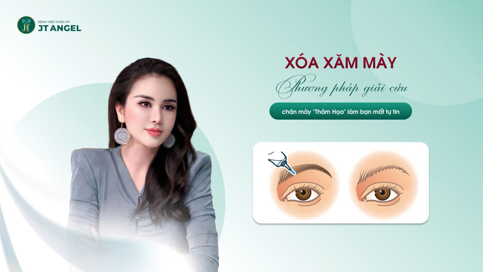 Xóa xăm mày: Phương pháp giải cứu chân mày "Thảm Họa" làm bạn mất tự tin